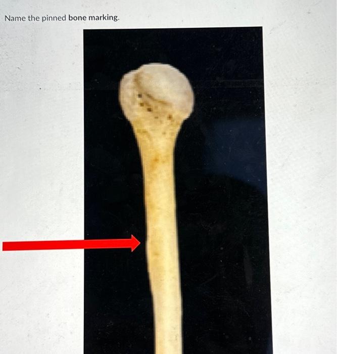 Solved Name the pinned bone marking. Name one | Chegg.com