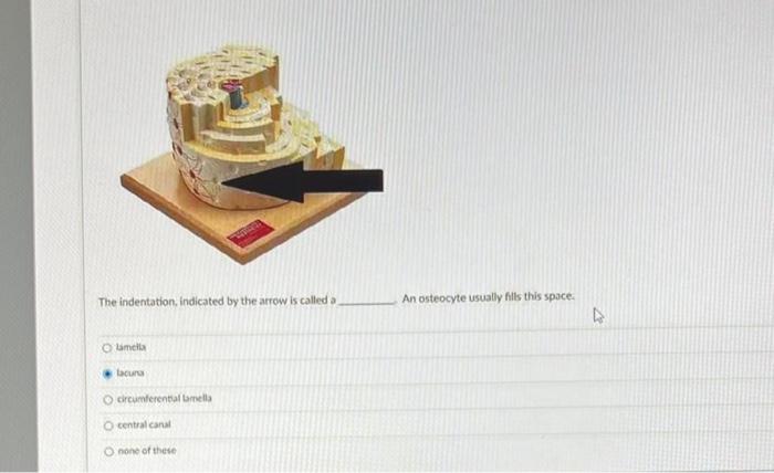 Solved The indentation, indicated by the arrow is called a | Chegg.com