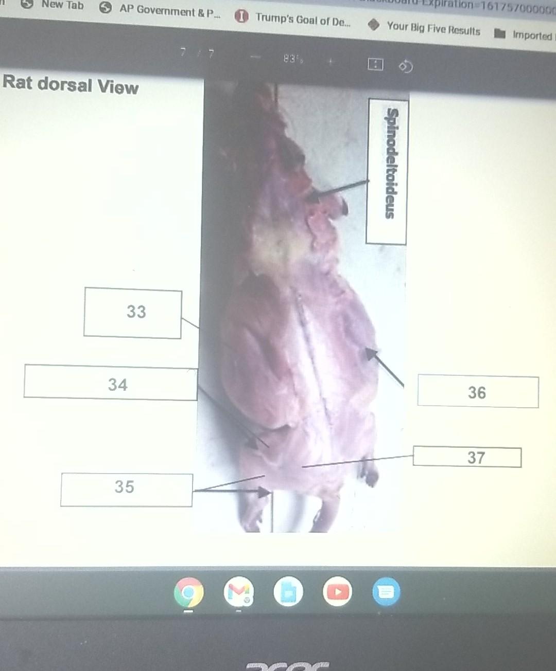 Solved elimb rat muscles Acromiotrapezius Spinodeltoideus | Chegg.com