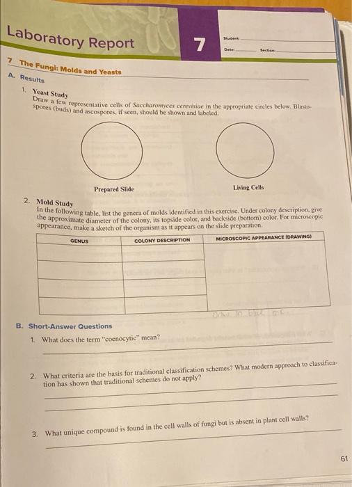Solved Laboratory Report St 7 Date Section 7 The Fungis | Chegg.com