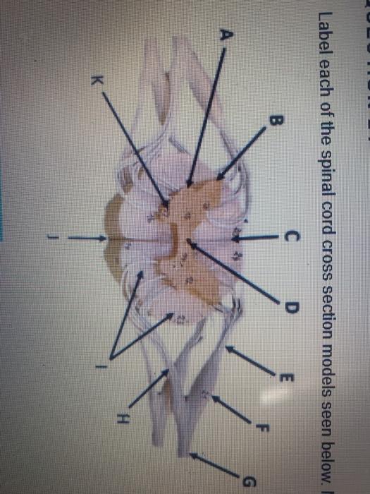 Solved Label each of the spinal cord cross section models | Chegg.com