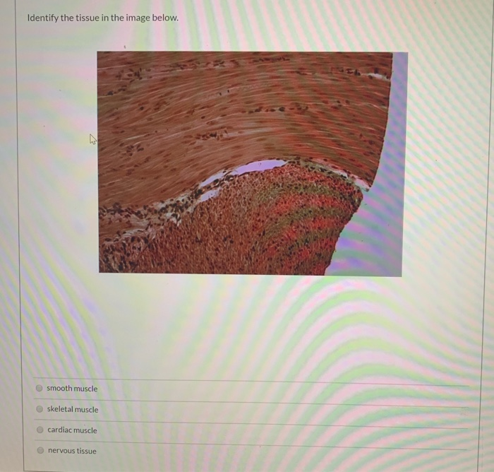 Solved Identify the tissue in the image below. smooth muscle | Chegg.com