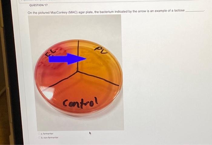 Solved QUESTION 17 On the pictured MacConkey (MAC) agar | Chegg.com