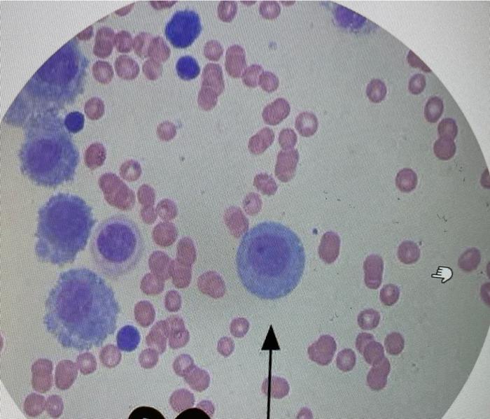 Solved identifybthe cells from a peritoneal fluid | Chegg.com
