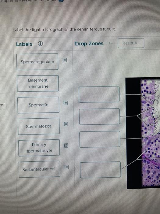 Solved Label the light micrograph of the | Chegg.com