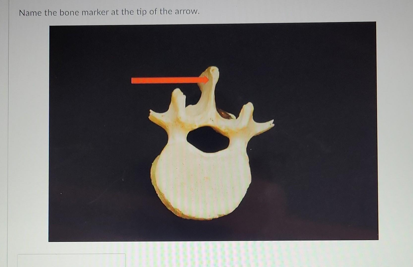 Solved Name the bone marker at the tip of the arrow. Name | Chegg.com
