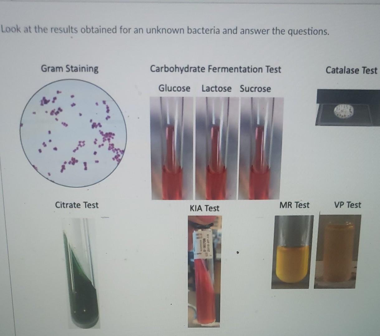 Solved Look at the results obtained for an unknown bacteria | Chegg.com