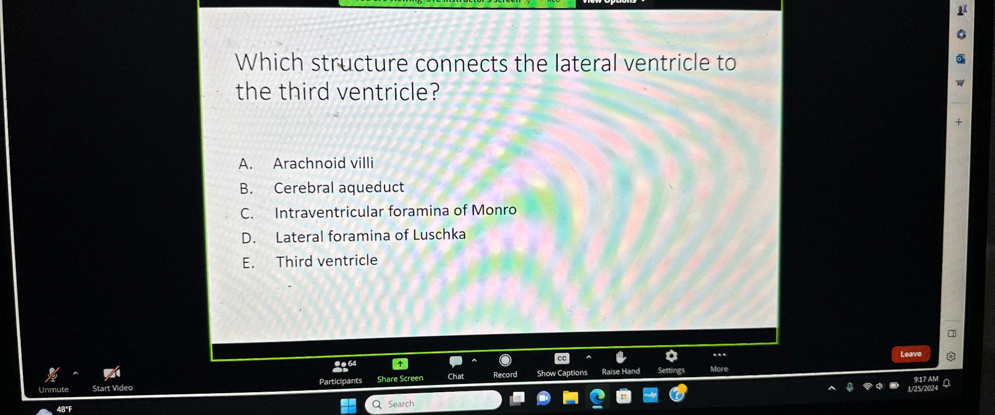 Solved Which structure connects the lateral ventricle to the | Chegg.com
