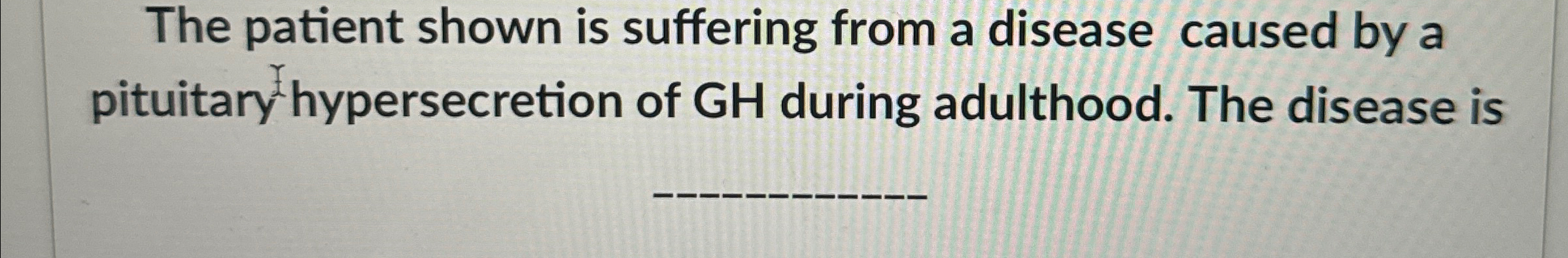 Solved The patient shown is suffering from a disease caused | Chegg.com