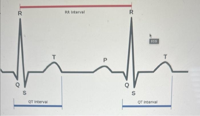 Solved Referencing the ECG trace below, which of the | Chegg.com