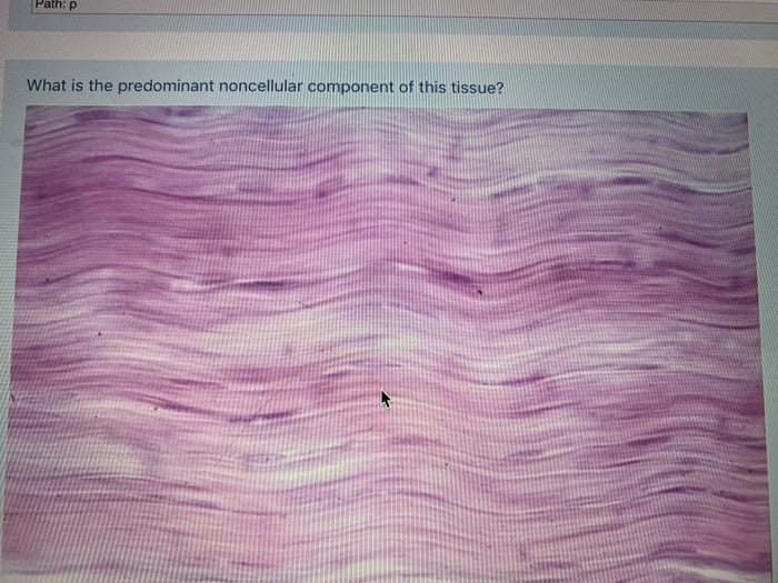 Solved What is the predominant cell type in this tissue? | Chegg.com