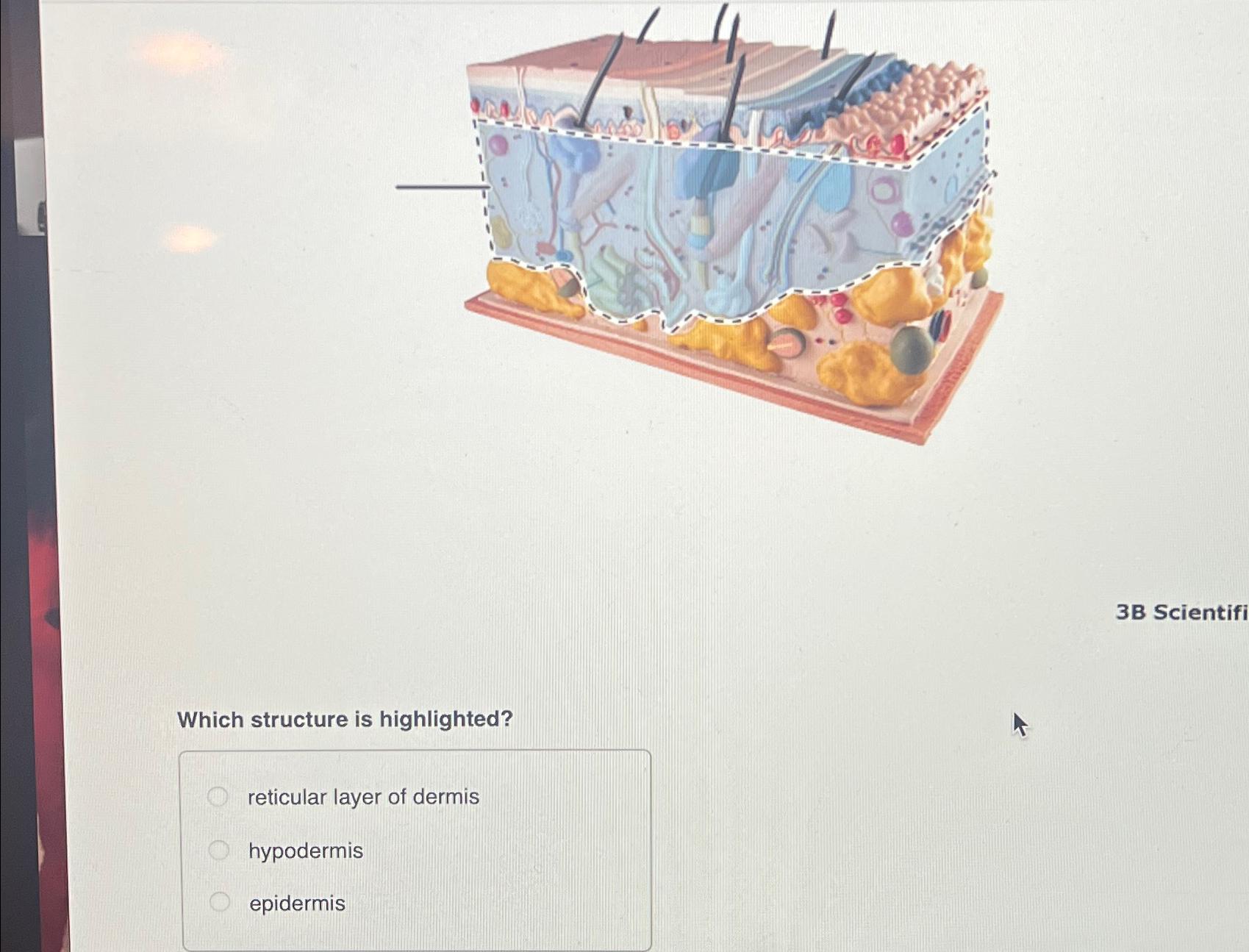 Solved Which structure is highlighted?reticular layer of | Chegg.com