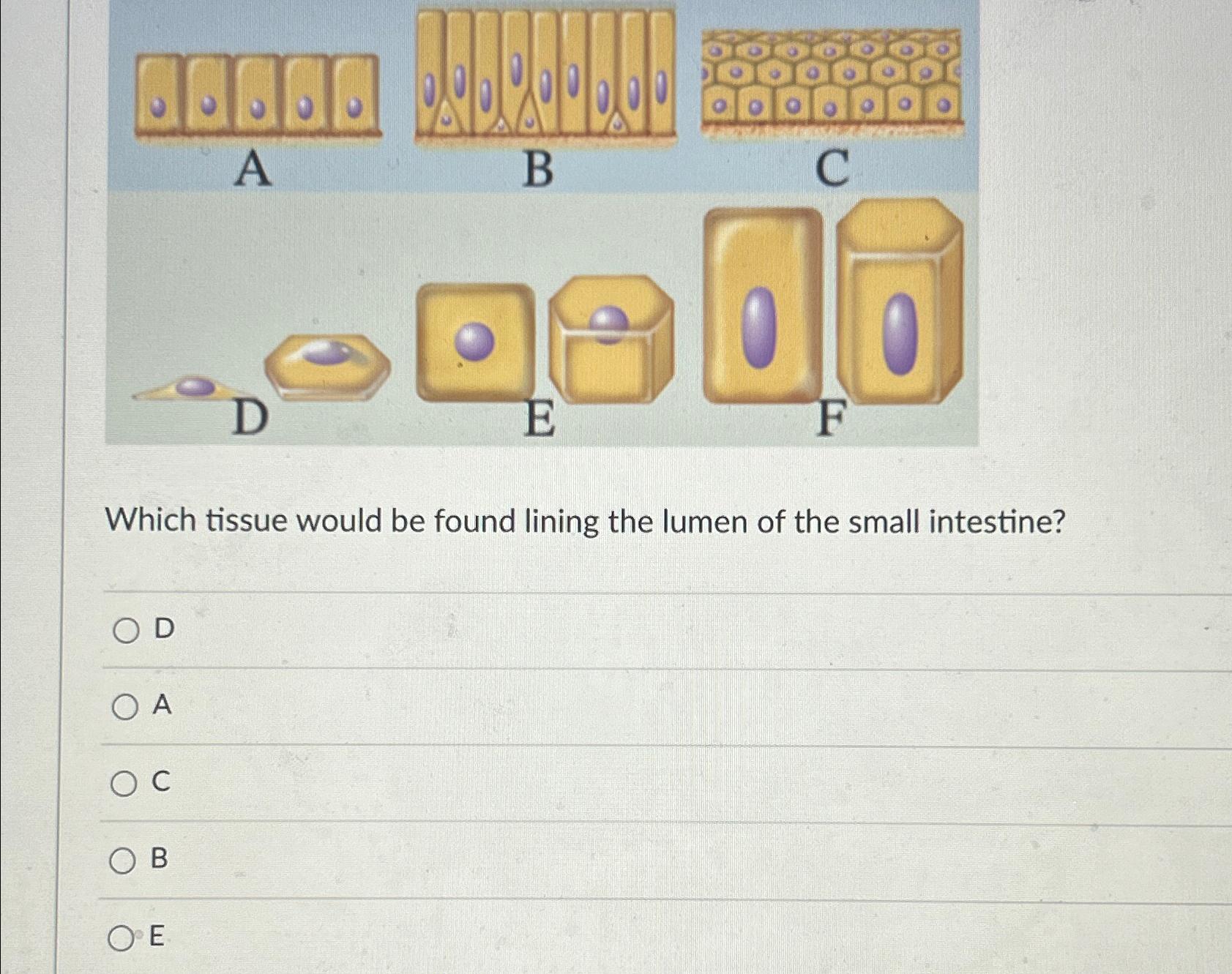 Solved Which tissue would be found lining the lumen of the | Chegg.com