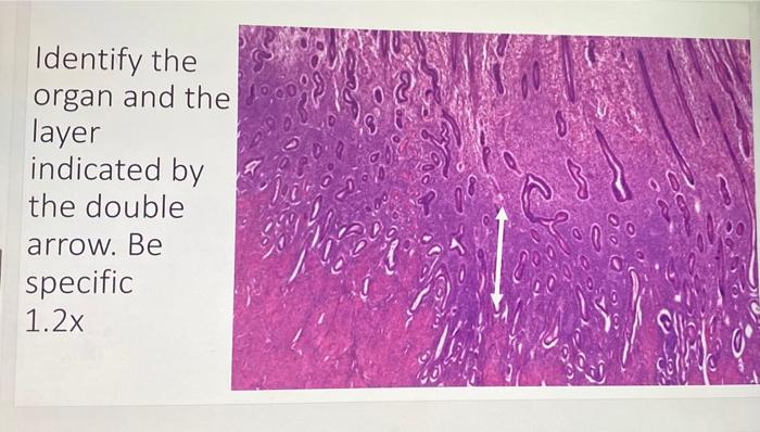 Solved Identify the organ and the layer indicated by the | Chegg.com
