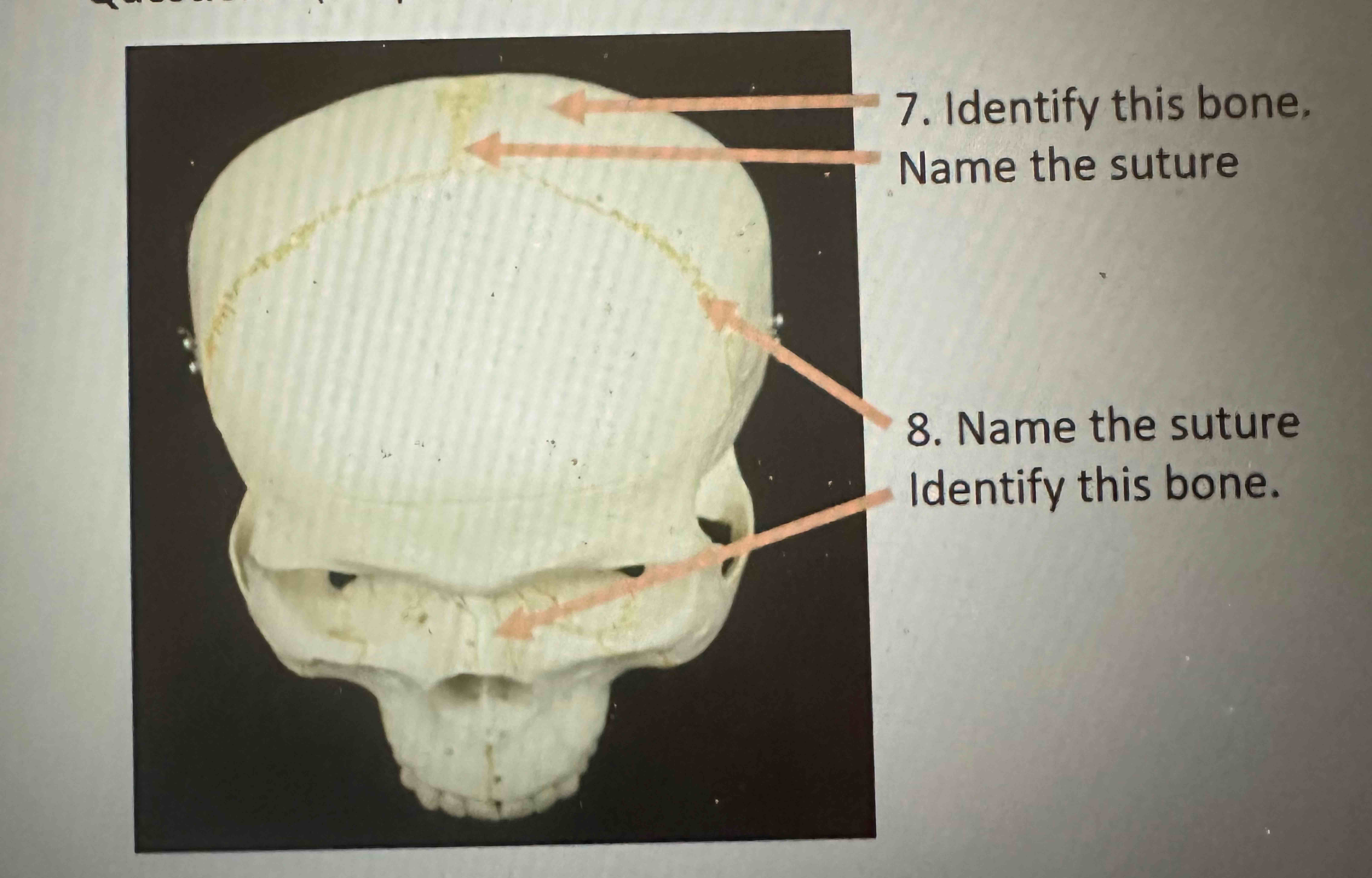 Solved 7. ﻿Identify this bone, Name the suture8. ﻿Name the | Chegg.com