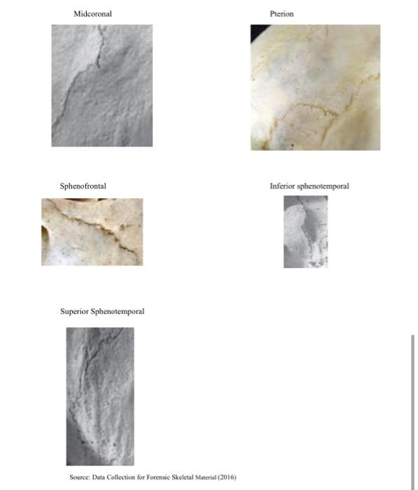 Ectocranium Sutures Midlambdoid Lambda Obelion | Chegg.com