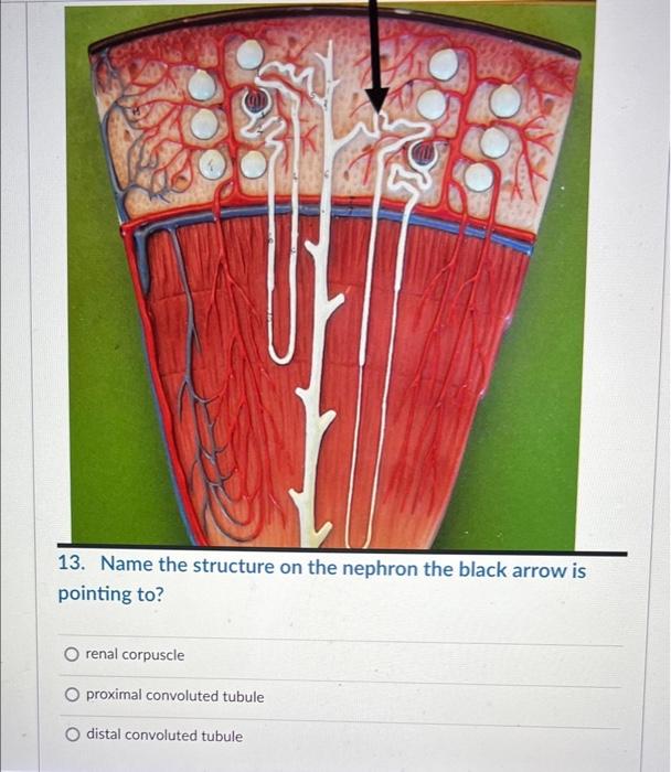 Solved 13. Name the structure on the nephron the black arrow | Chegg.com