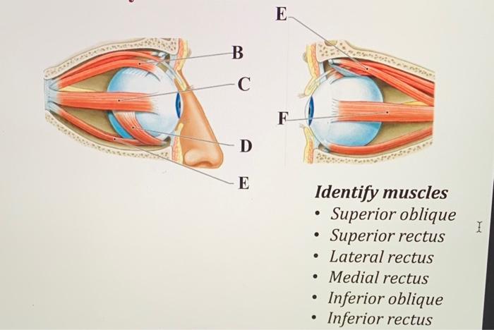 Solved Identify muscles - Superior oblique - Superior rectus | Chegg.com