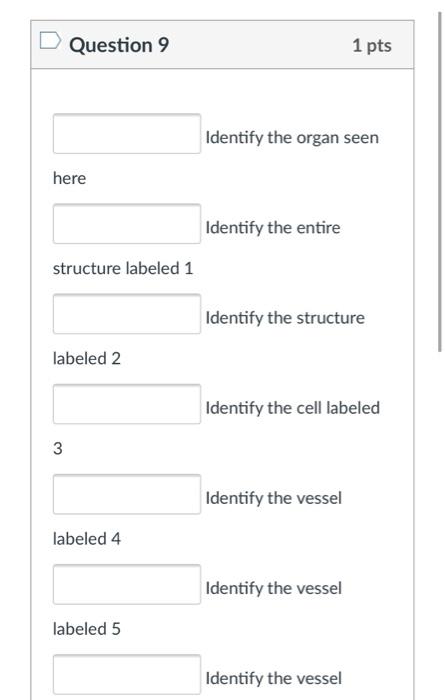 Solved Identify the vessel labeled 5 Identify the vessel | Chegg.com