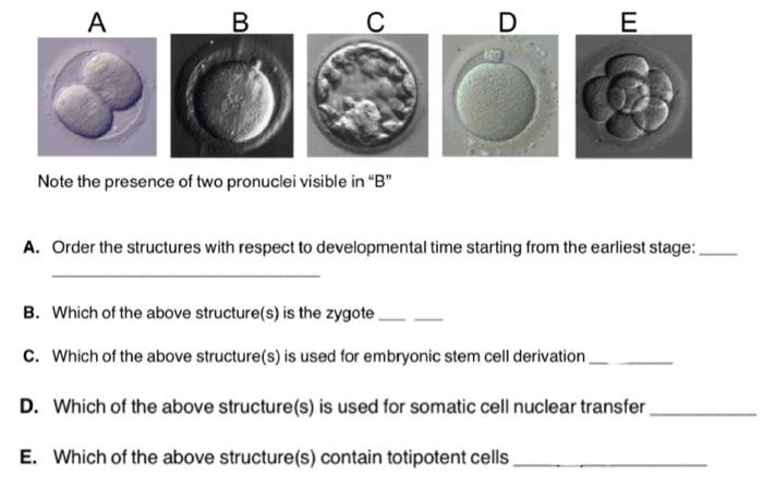 Solved Note the presence of two pronuclei visible in " B " | Chegg.com