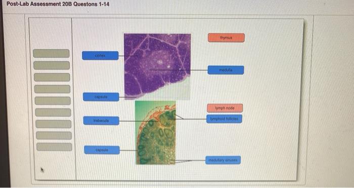 Solved Post-Lab Assessment 20B Questons 1-14 Thymus code med | Chegg.com
