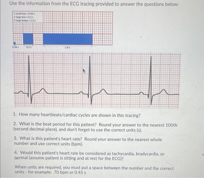 Solved Use the information from the ECG tracing provided to | Chegg.com