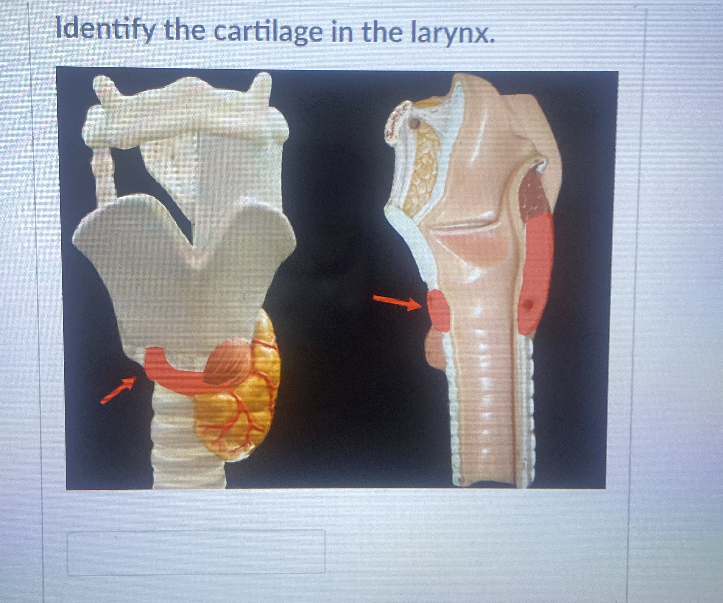 Solved Identify the cartilage in the larynx. | Chegg.com
