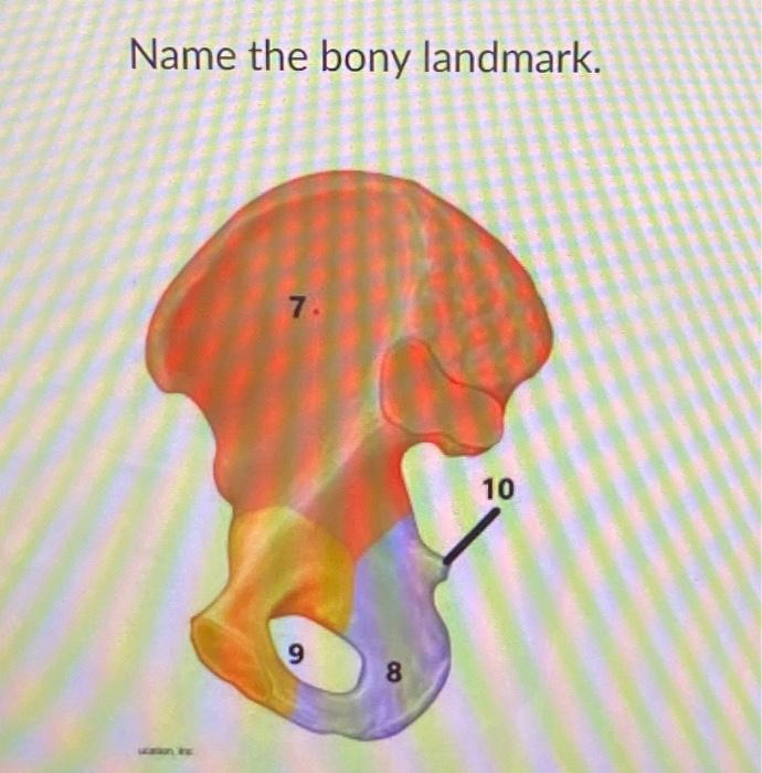 Solved Name the bony landmark. | Chegg.com