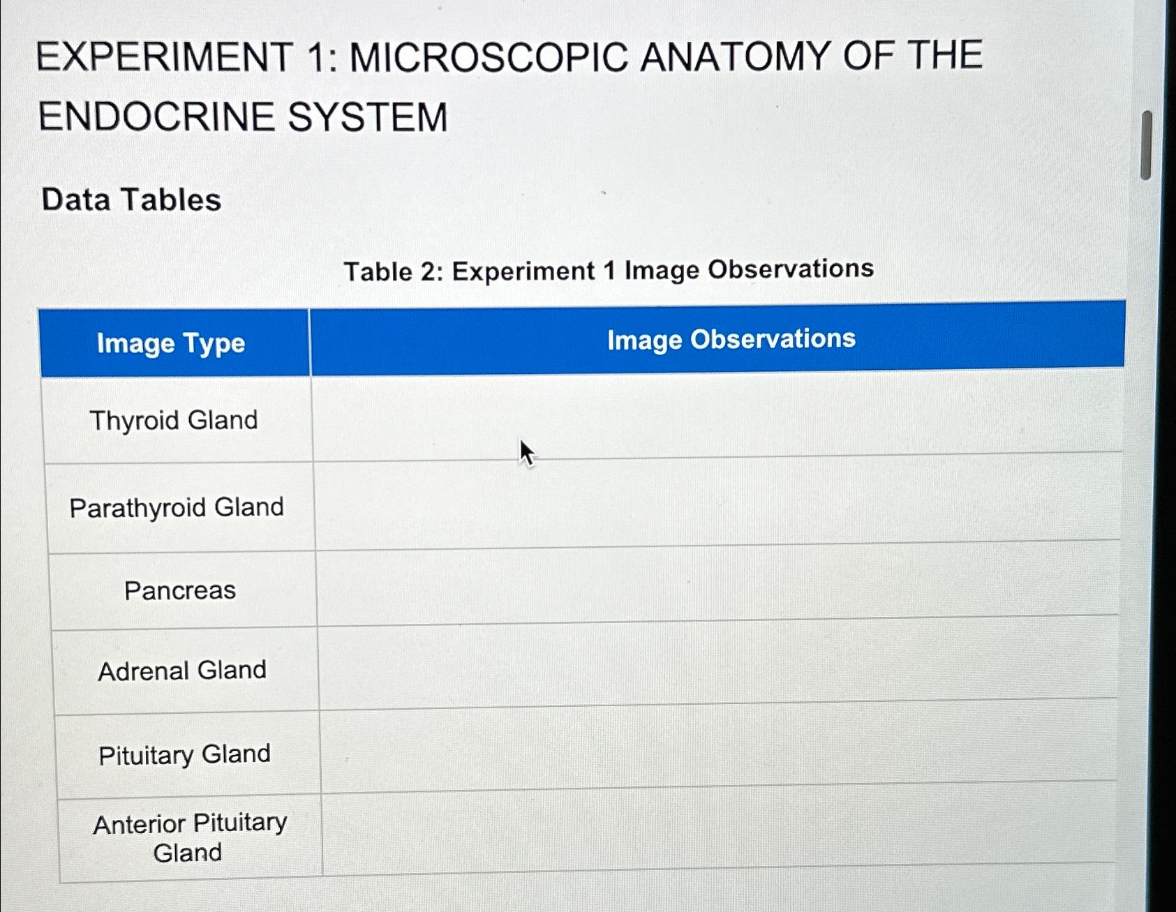 Solved EXPERIMENT 1: MICROSCOPIC ANATOMY OF THE ENDOCRINE | Chegg.com