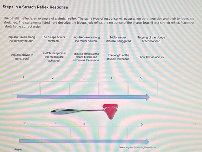 Solved Steps In a Stretch Reflex Response The patellar | Chegg.com