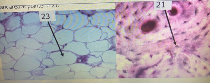 Solved QUESTION 6 21. Identify the tissue at pointer # 21. | Chegg.com