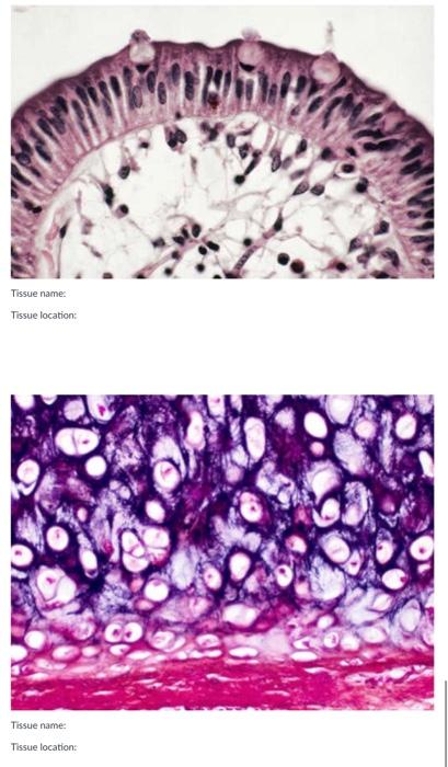 Solved Tissue Name: Tissue Location (only 1): Tissue | Chegg.com