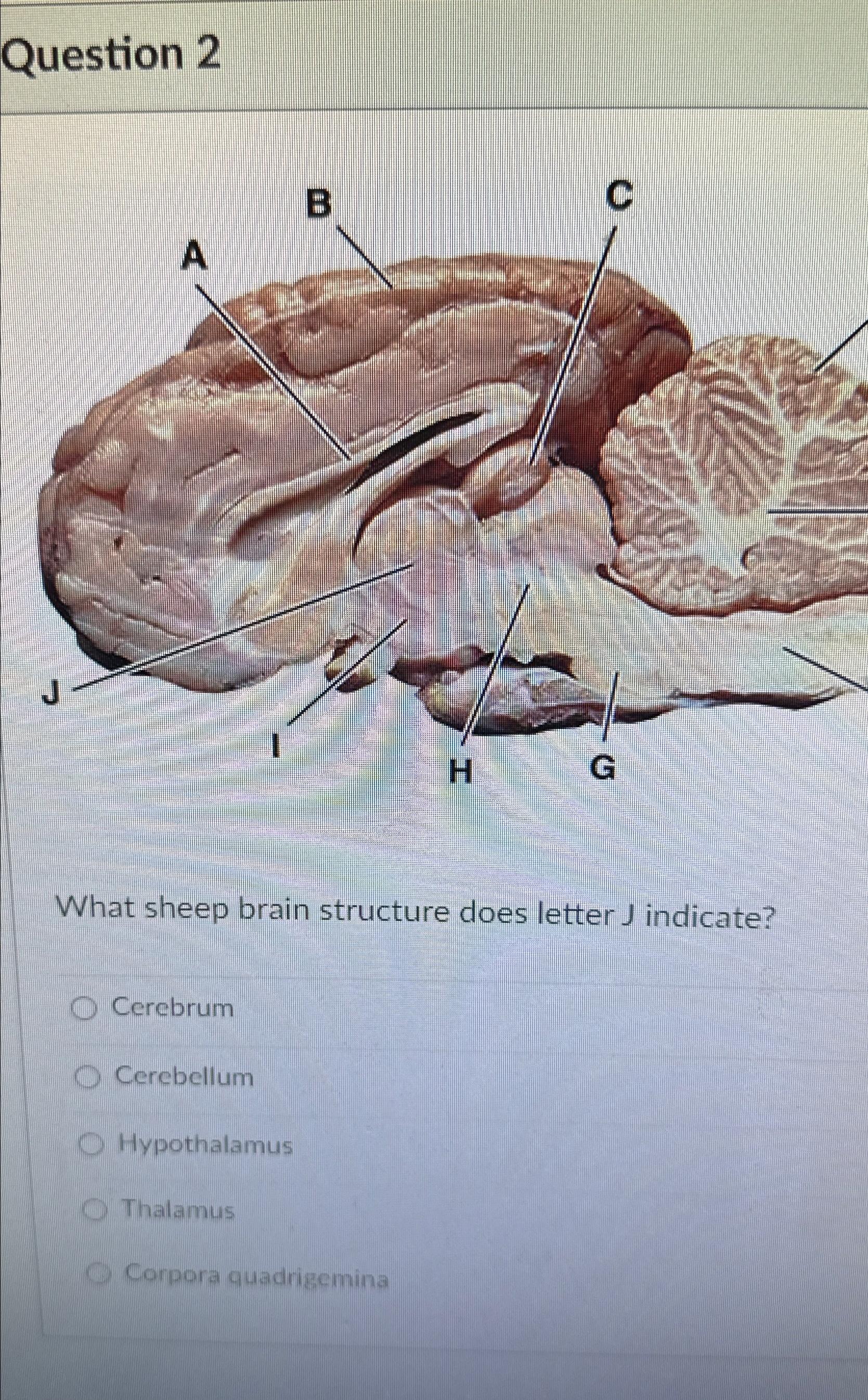 Solved Question 2 ﻿What sheep brain structure does letter J | Chegg.com