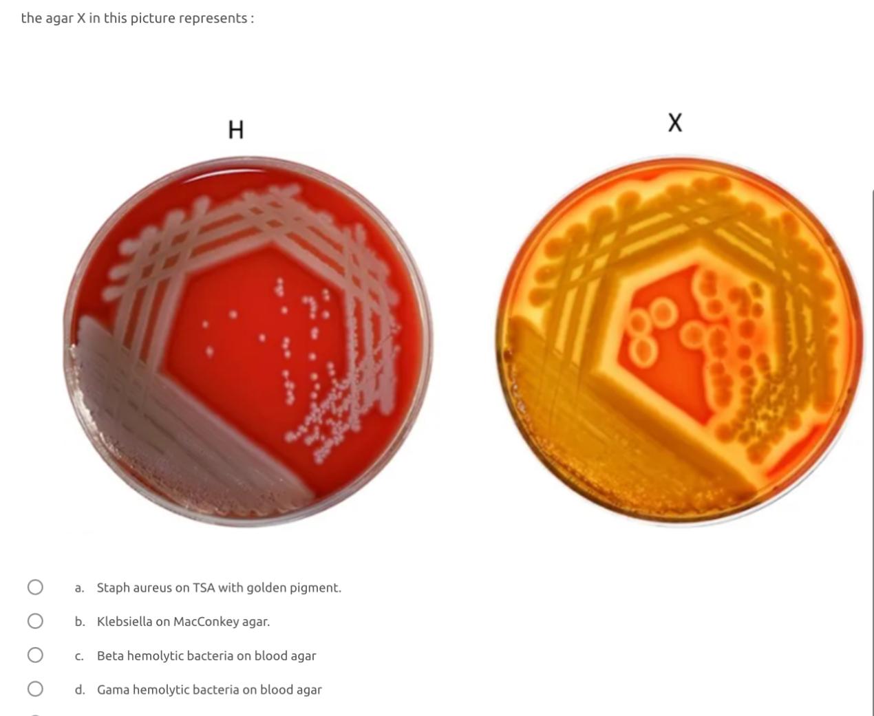 Solved the agar x ﻿in this picture represents :a. ﻿Staph | Chegg.com
