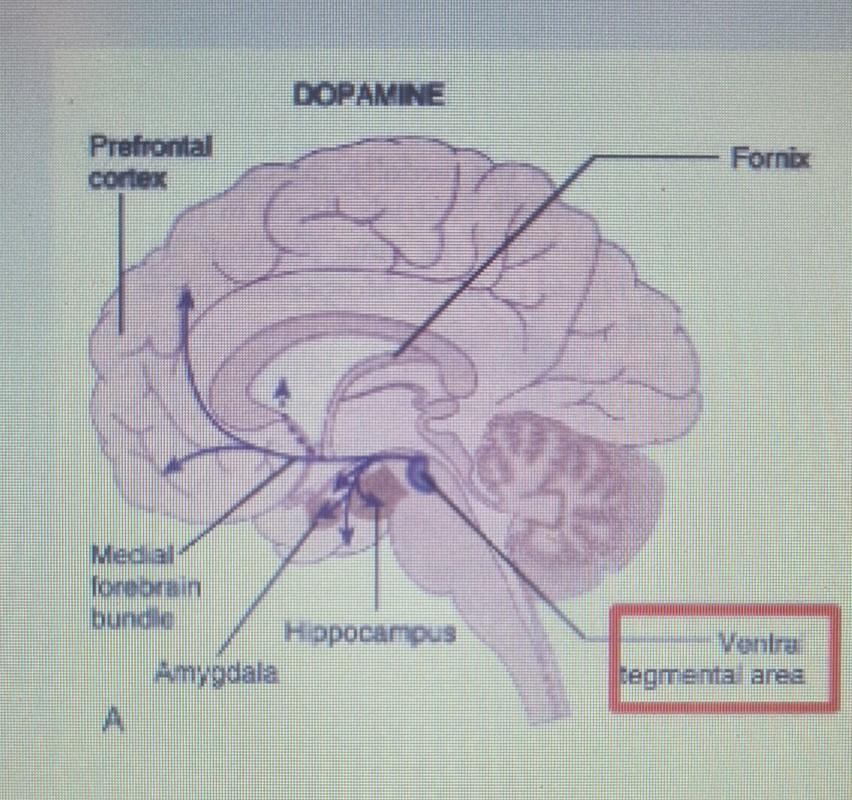 Solved DOPAMINE Prefrontal Cortex Forne Med fonetan | Chegg.com