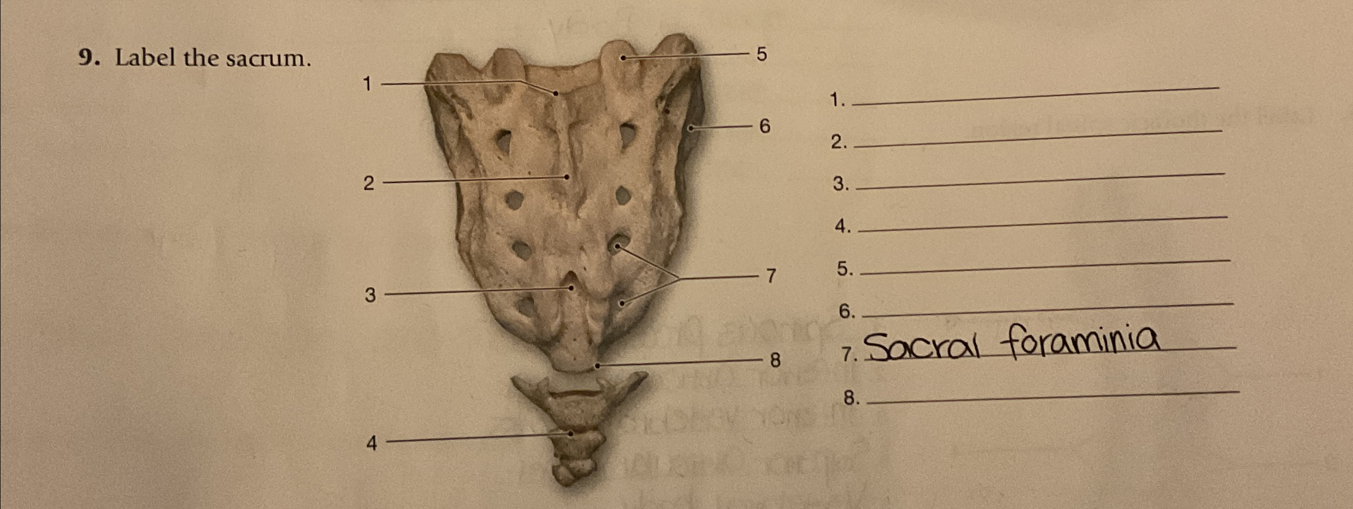 Solved Label the sacrum. q, q,q,q, 7. ﻿Sacral toraminia88 | Chegg.com