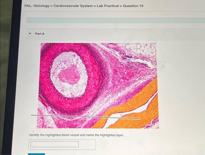Solved PAL: Histology > Cardiovascular System > Lab | Chegg.com