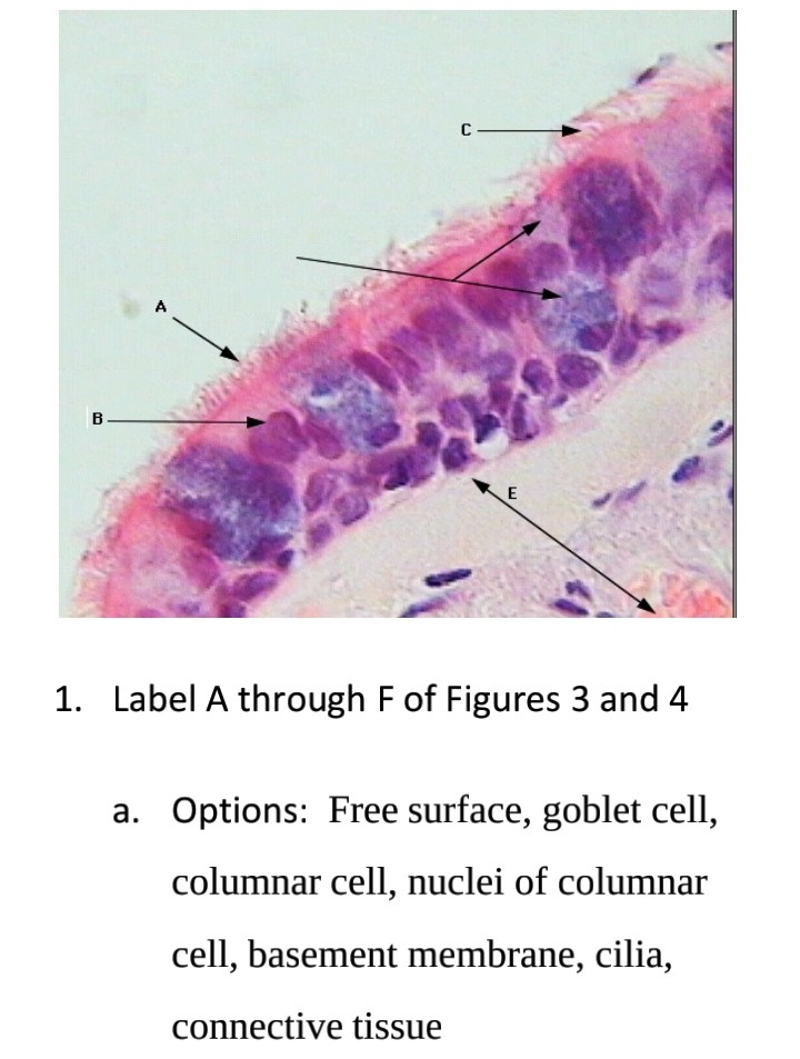 Solved C- A B E 1. Label A through F of Figures 3 and 4 a. | Chegg.com