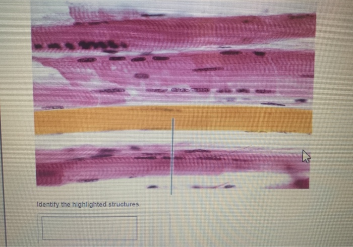 Solved Identify the highlighted structures. | Chegg.com