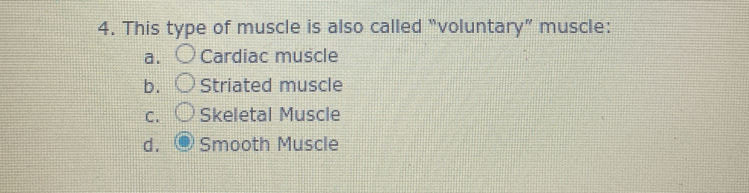 Solved This type of muscle is also called "voluntary" | Chegg.com