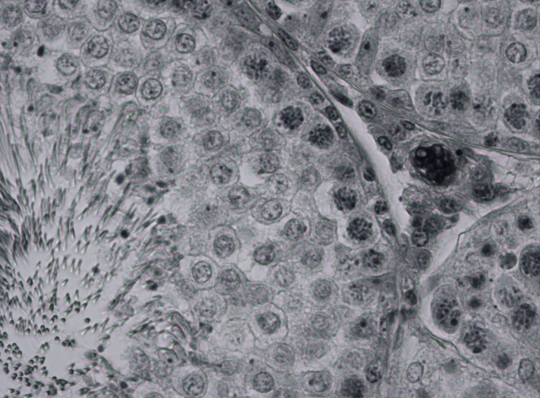 Solved Basement membrane / ﻿basal lamina (same thing)• | Chegg.com