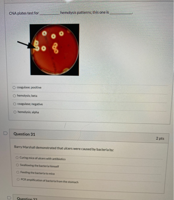 Solved CNA plates test for hemolysis patterns; this one is | Chegg.com