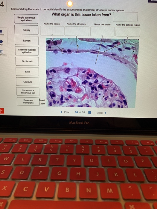 Solved click and drag the labels to correctly identify the | Chegg.com