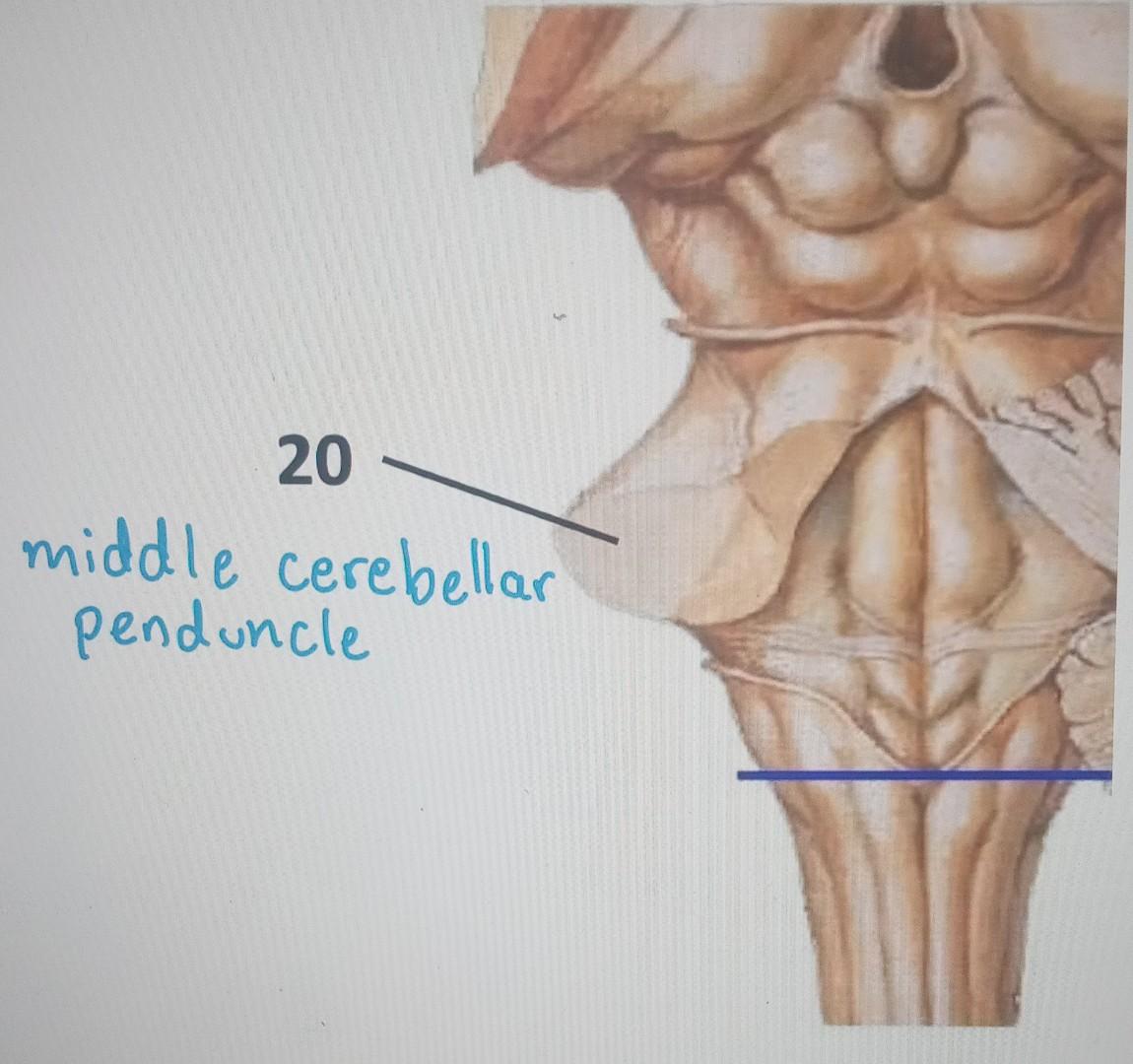 Solved please label ALL the structures seen in the pictures | Chegg.com