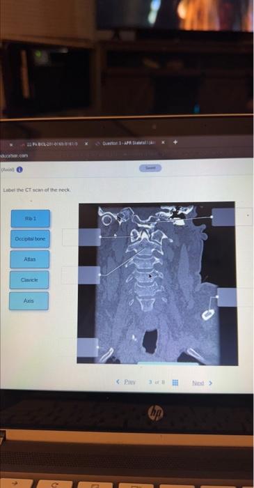 Solved Label the CT scan of the neck | Chegg.com