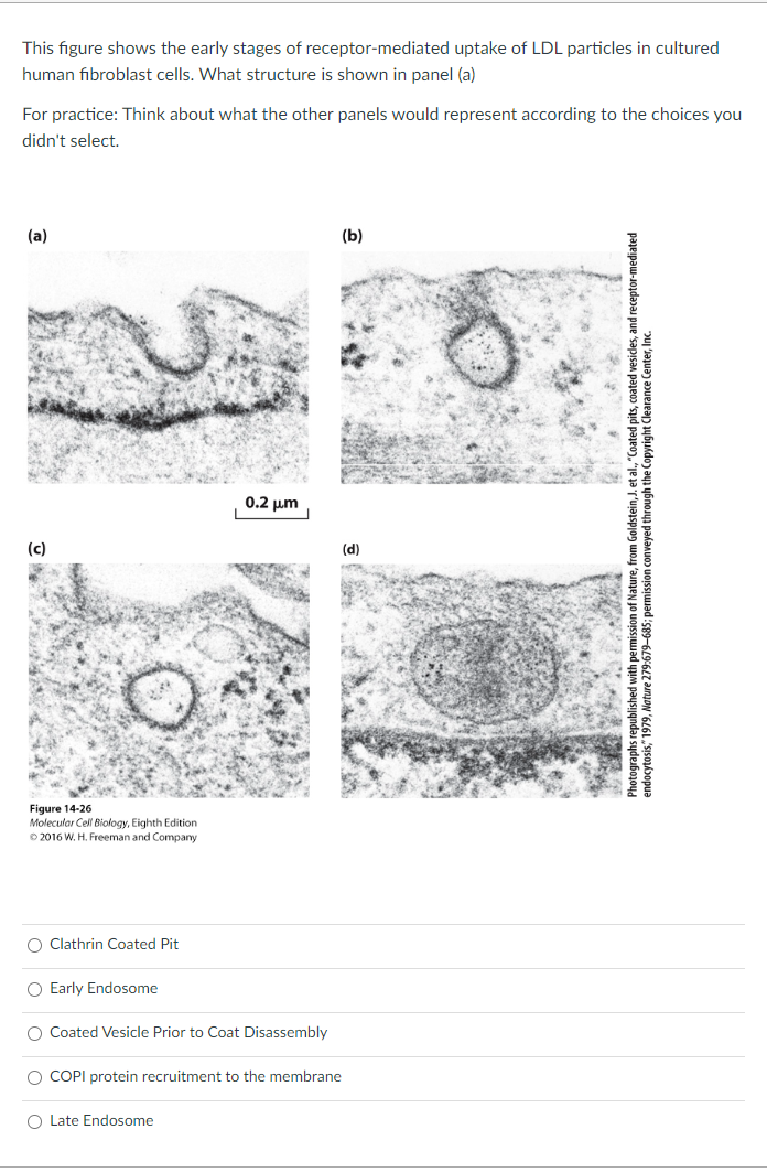 Solved This figure shows the early stages of | Chegg.com