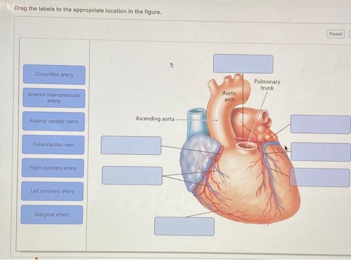 Solved label the arteries of the coronary circulation on the | Chegg.com