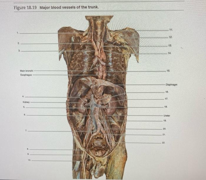 Solved Figure 18.19 Major blood vessels of the trunk. 11 12 | Chegg.com