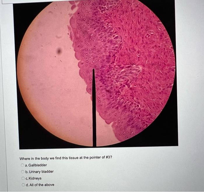 Solved Where in the body we find this tissue at the pointer | Chegg.com