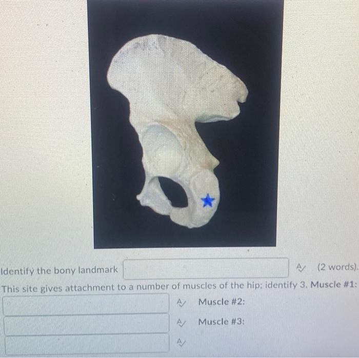 Solved Identify the bony landmark A (2 words). This site | Chegg.com